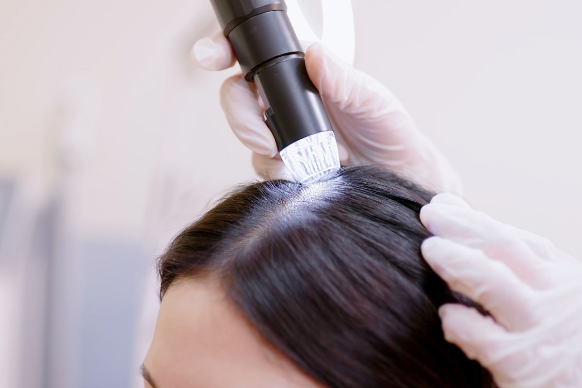 Grzybica skóry głowy – jak ją rozpoznać i leczyć? Mojaapteka.pl